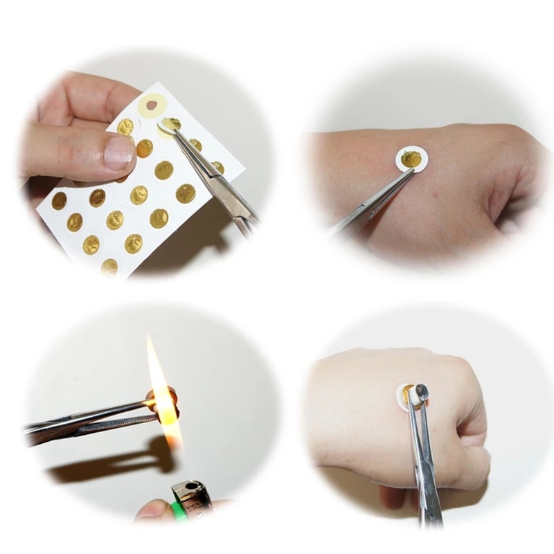 225pcs self-adhesive moxa tube